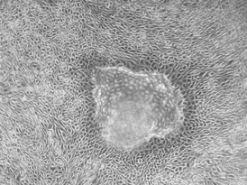 PKD Cell Engineering Core – Woodward Laboratory